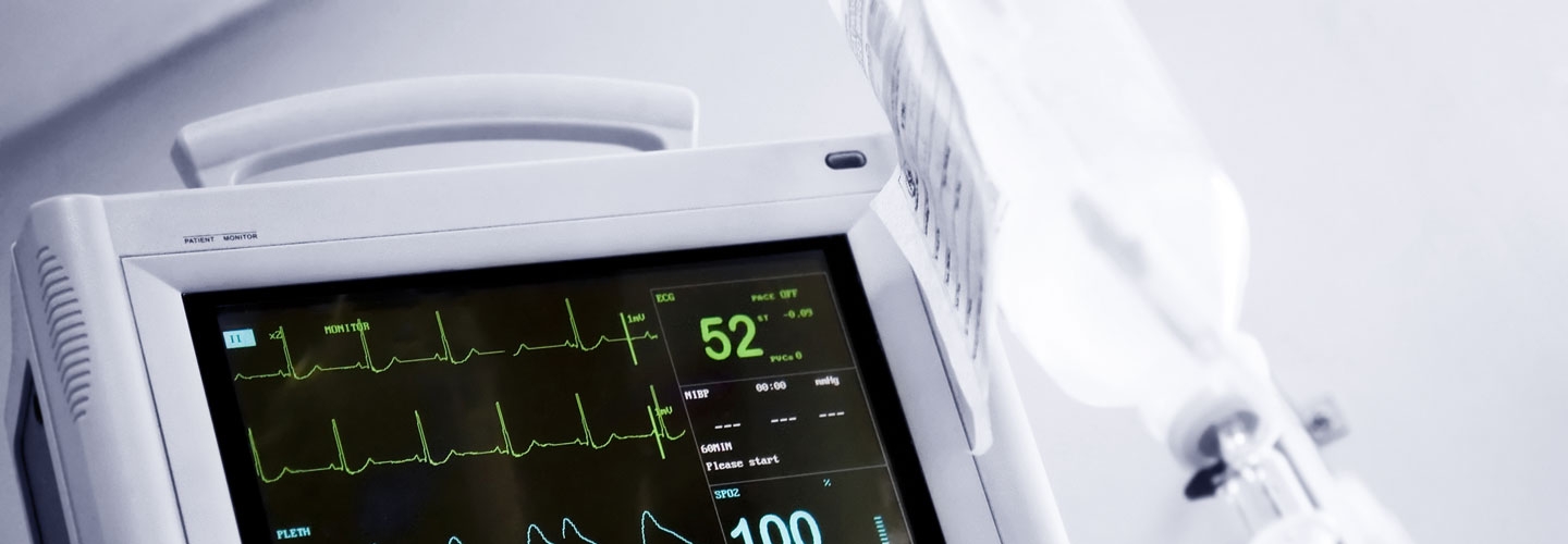 Elektrokardiogramm (EKG) | Kardiovaskuläres Zentrum Darmstadt